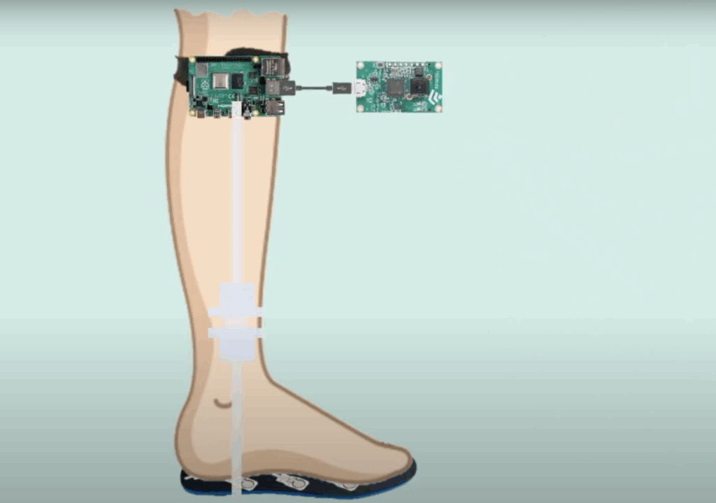 Foot pressure sensors detect Parkinson's disease - Raspberry Pi
