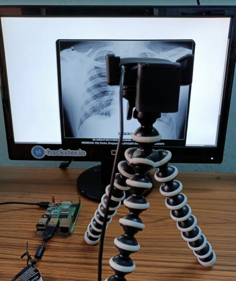 Pneumonia detection — Raspberry Pi Official Magazine