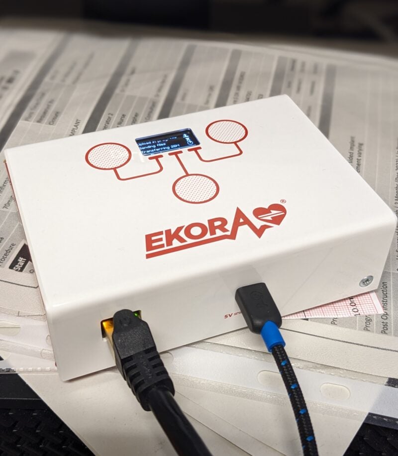 라즈베리파이 성공 스토리, 활용 사례 (의료) - EKORA : 네이버 블로그